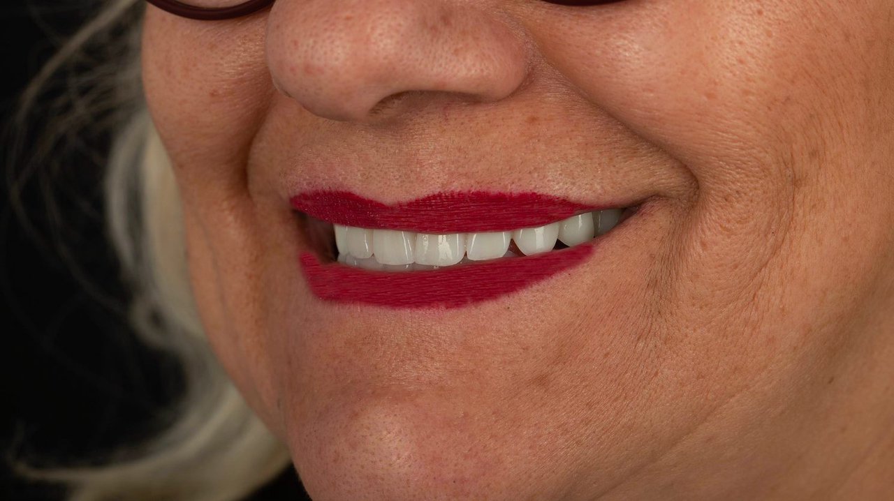 Smile Dent Team te ajută să obții un zâmbet de vis prin reabilitarea ...